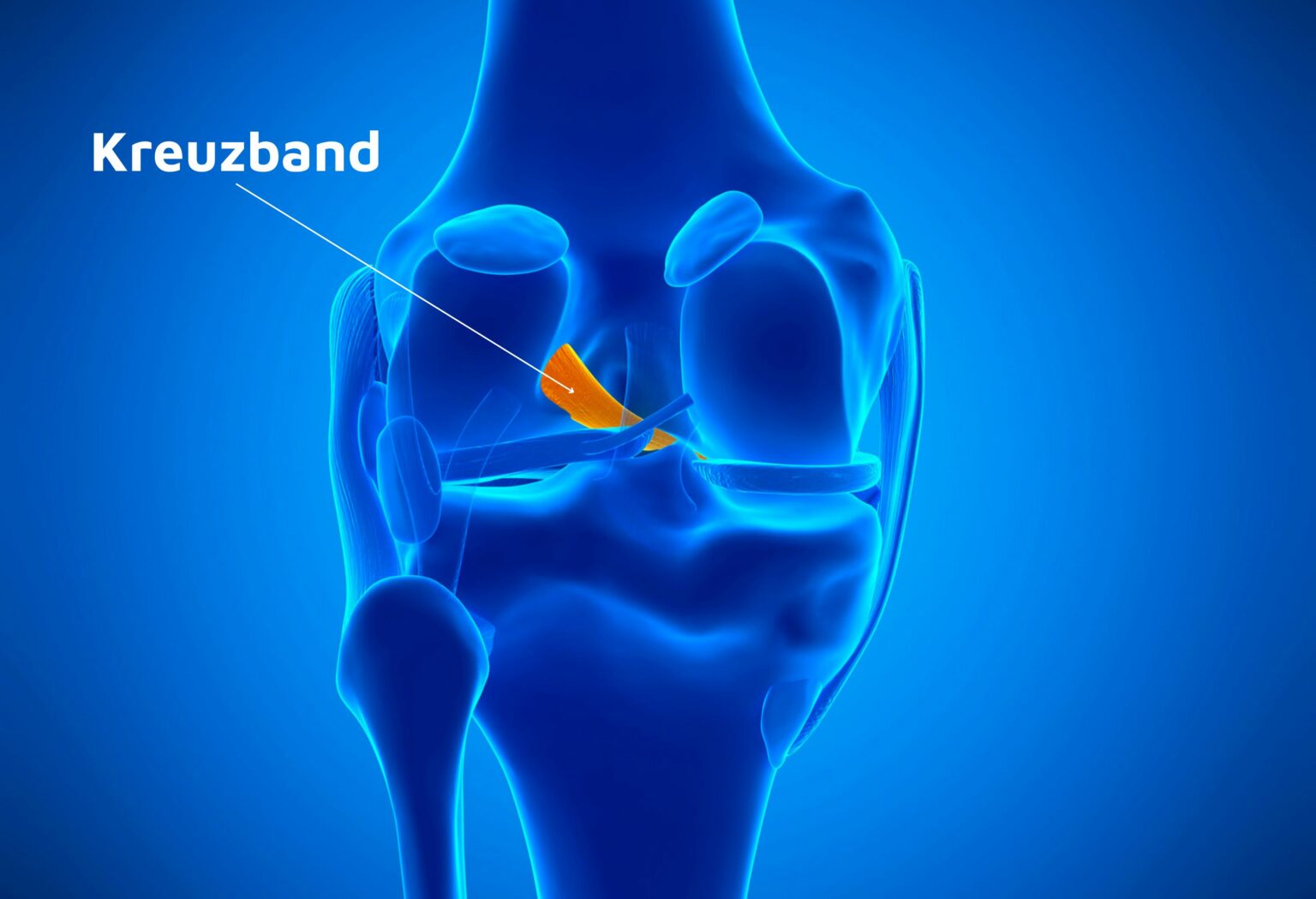 Runner's Knee - der große Ratgeber - OPTIMALEFITNESS