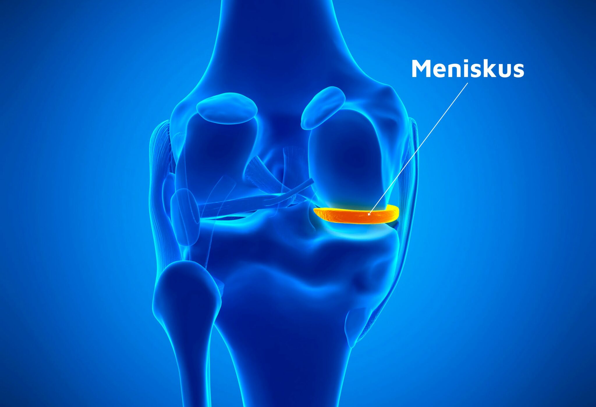 Runner's Knee - der große Ratgeber - OPTIMALEFITNESS