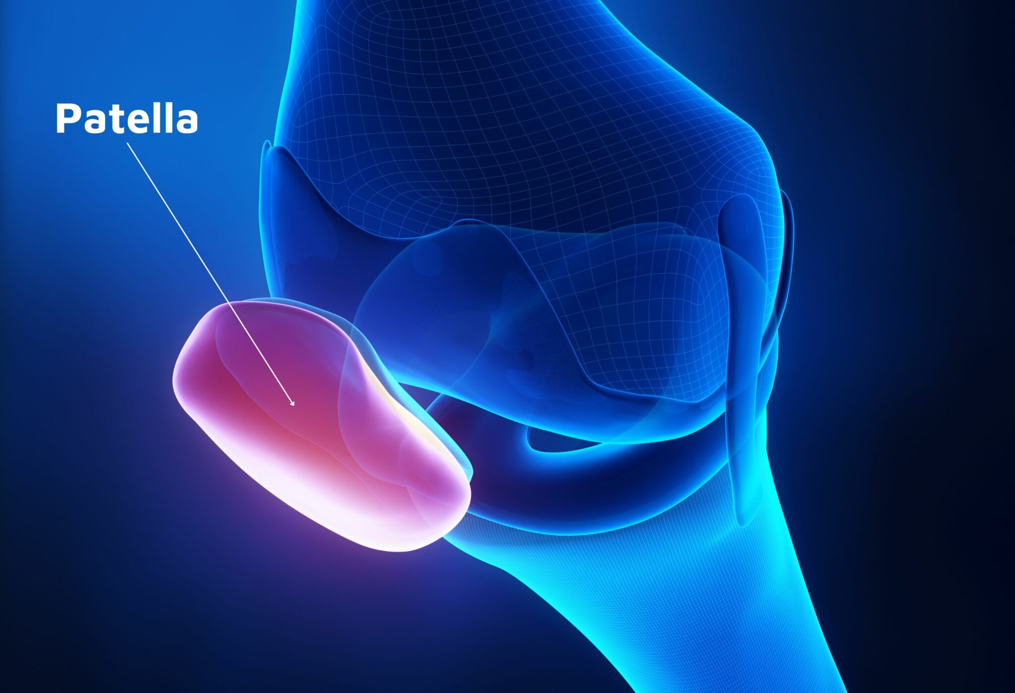 Runner's Knee - der große Ratgeber - OPTIMALEFITNESS