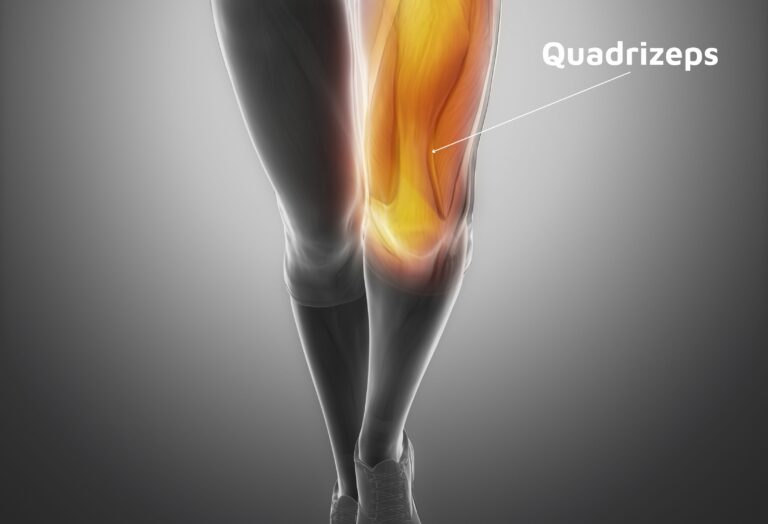 Runner's Knee - der große Ratgeber - OPTIMALEFITNESS